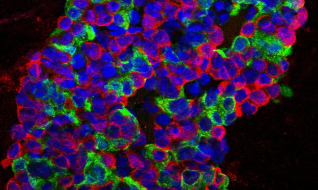 Scotblood | Major milestone reached by Scottish transplant scheme